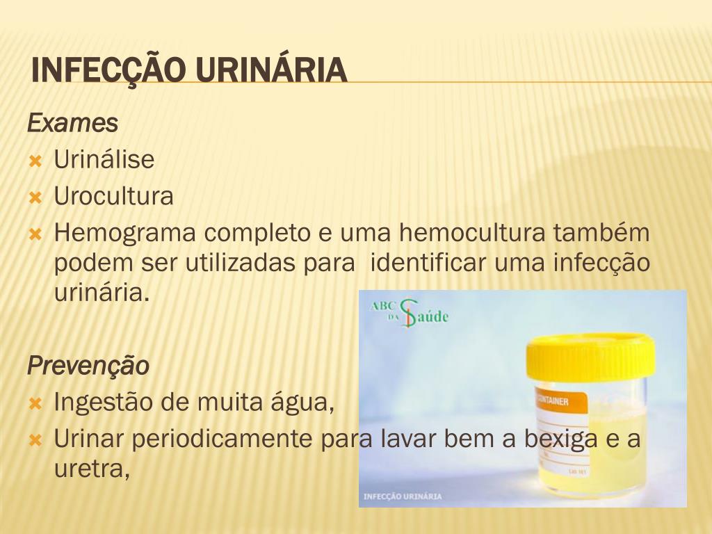PPT - Doenças Urológicas PowerPoint Presentation, free download - ID ...