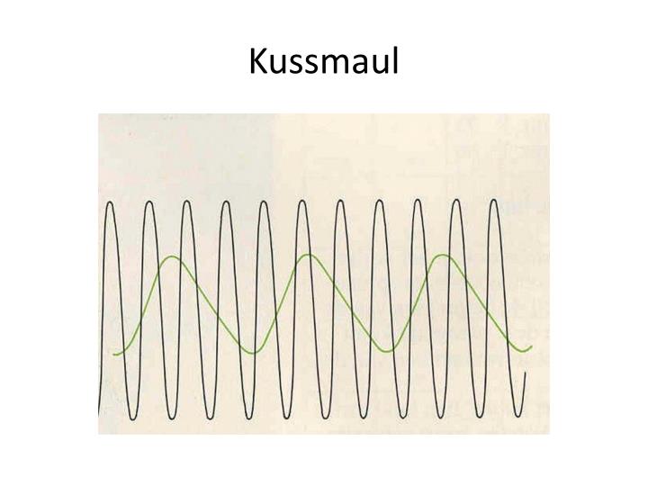 Kussmaul Ademhaling DSMS Dansk Selskab For Massespektrometri