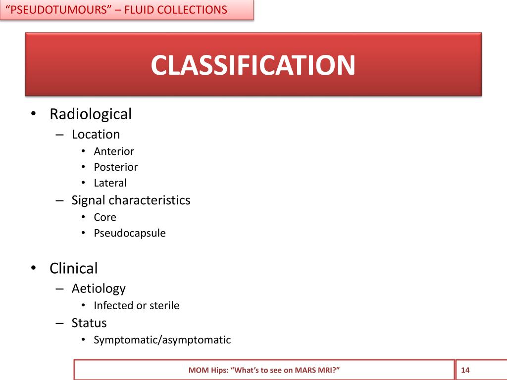 PPT - Metal-on-metal hips. “What’s to see on MRI?” PowerPoint ...
