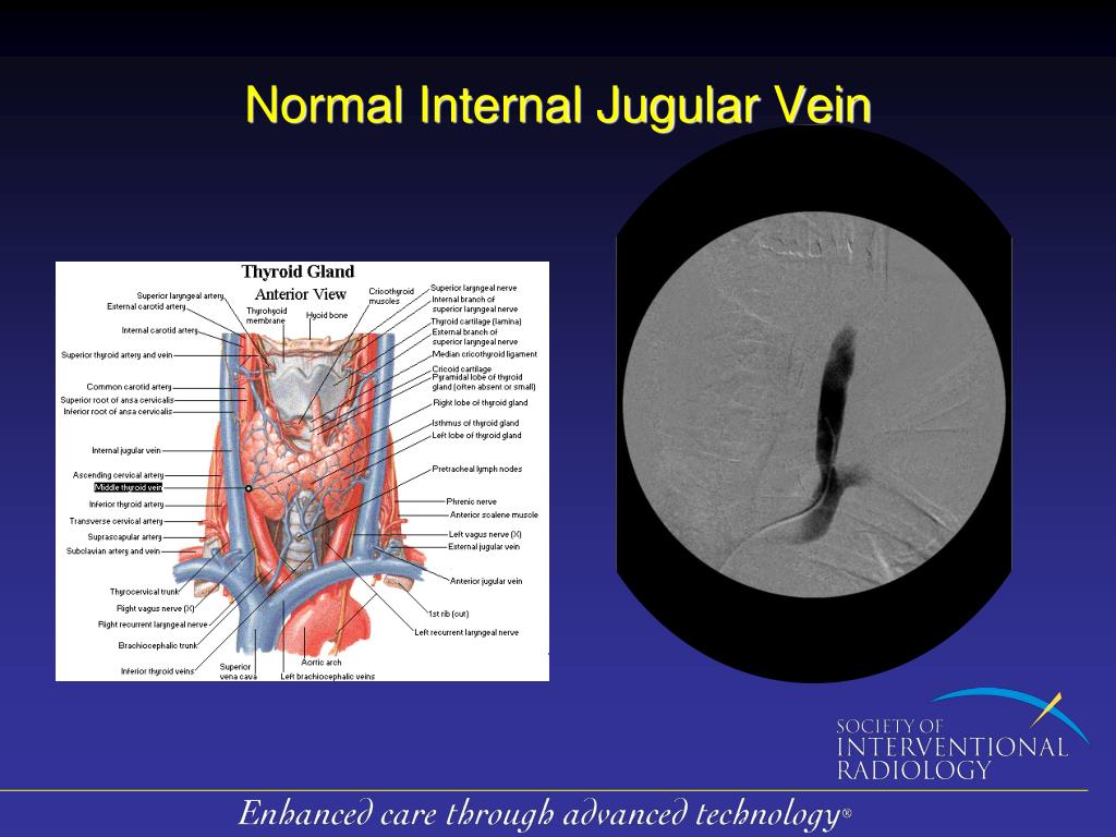 PPT - Kenneth Mandato, MD Meridith Englander, MD Gary Siskin, MD ...