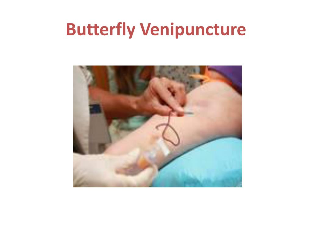 PPT - CVT Exam Room MED 250 PowerPoint Presentation, free download - ID ...