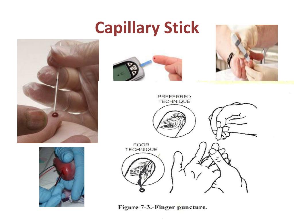 PPT - Comprehensive Guide to Vital Signs, Pain Assessment, and Blood ...