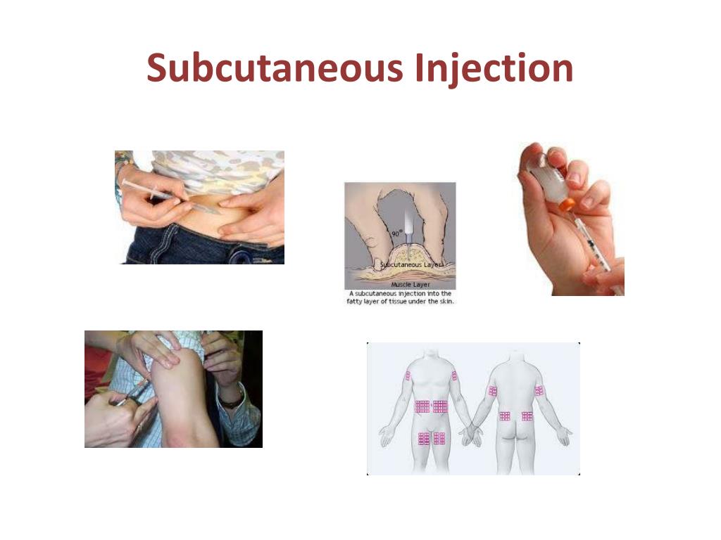 PPT - CVT Exam Room MED 250 PowerPoint Presentation, free download - ID ...