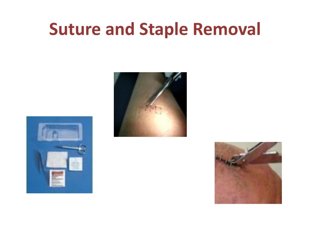 PPT - CVT Exam Room MED 250 PowerPoint Presentation, free download - ID ...