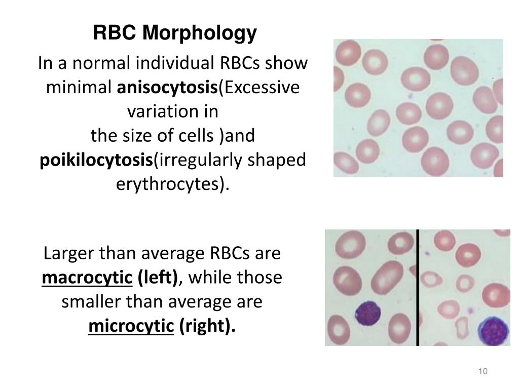 PPT - BLOOD 2 RED BLOOD CELLS JAUNDICE ANEMIA & POLYCYTHEMIA PowerPoint ...