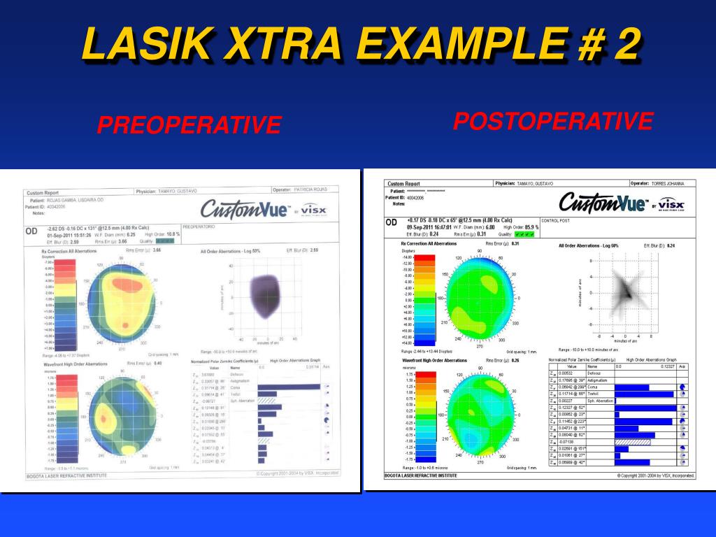 PPT - CENTRO OFTALMOLOGICO GUSTAVO TAMAYO BOGOTA COLOMBIA PowerPoint ...