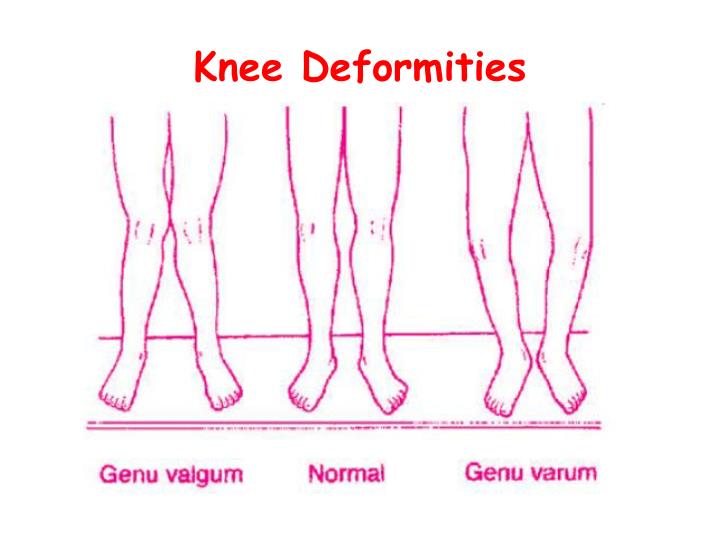 PPT - Physical Examination in Occupational Medicine PowerPoint ...
