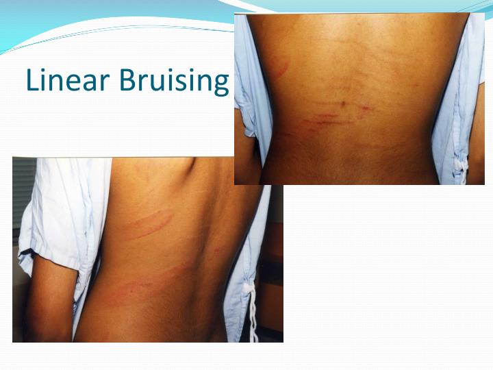 PPT - Child Abuse Investigation: Forensic Issues PowerPoint ...