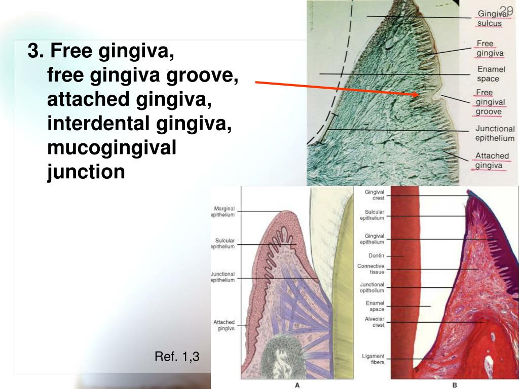 PPT - Oral Mucosa & Salivary Gland 口腔黏膜及唾液腺 PowerPoint Presentation ...