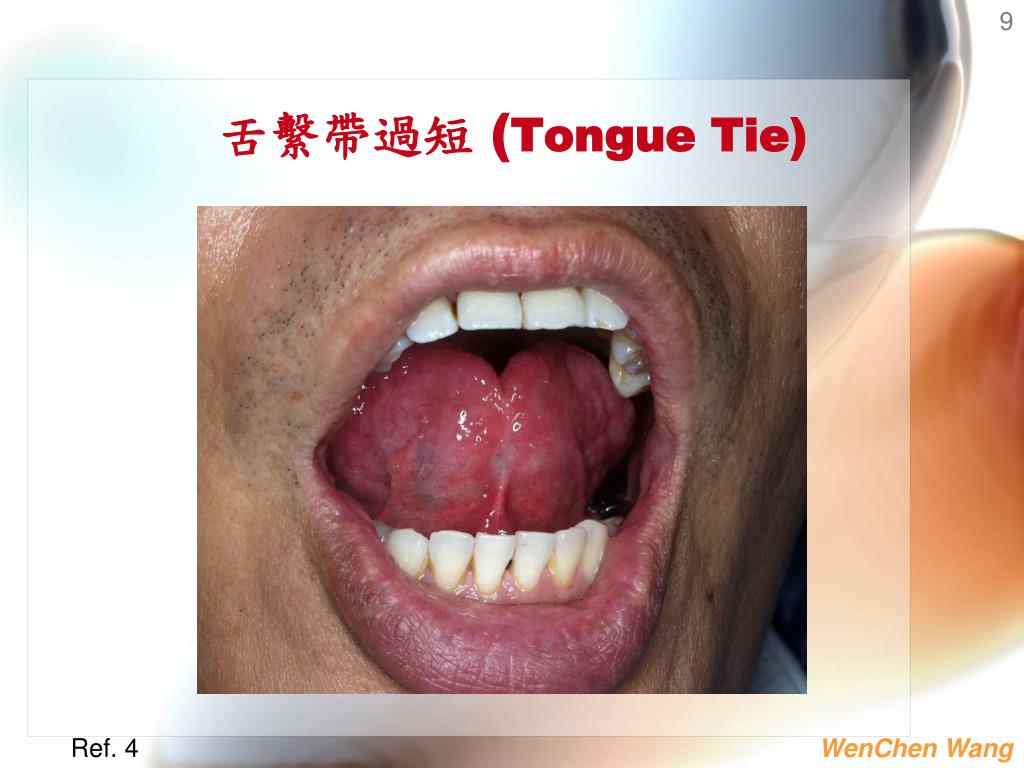 PPT - Oral Mucosa & Salivary Gland 口腔黏膜及唾液腺 PowerPoint Presentation ...