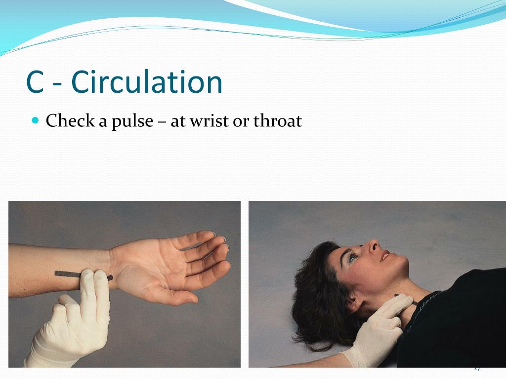 PPT - Tenderfoot Requirement #12 a. Demonstrate how to care for someone ...