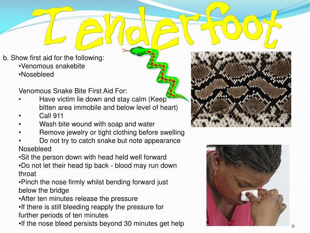 PPT - Tenderfoot Requirement #12 a. Demonstrate how to care for someone ...