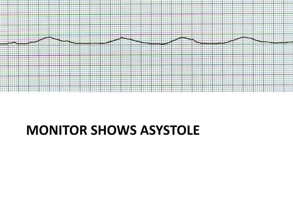 PPT - Management of the Agitated Patient Adam Watchorn July 28, 2011 ...