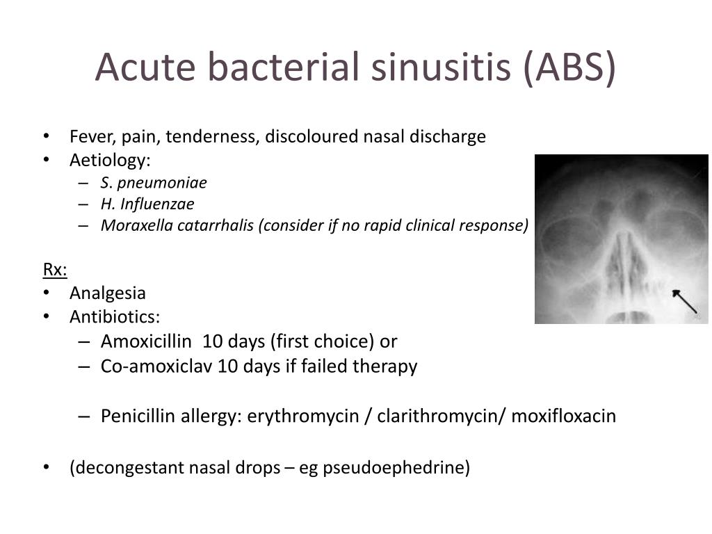 PPT - Nose, sinus, nasopharynx Dr K Outhoff PowerPoint Presentation, free download - ID:1872055
