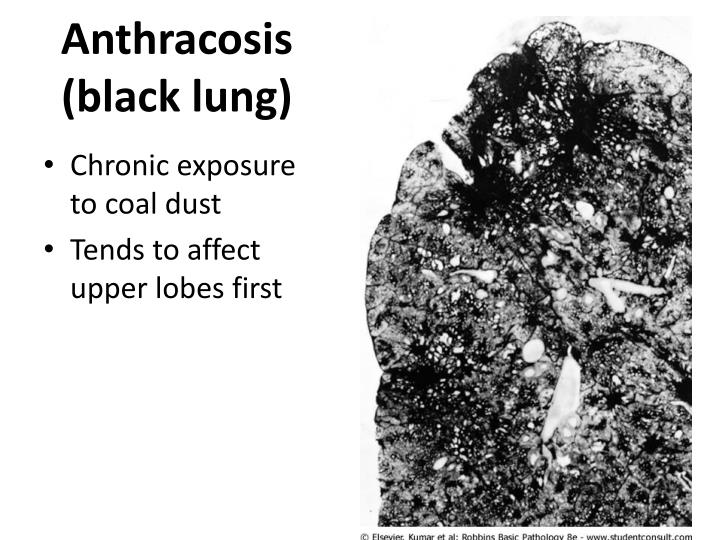 PPT - Respiratory Diseases PowerPoint Presentation - ID:1872347