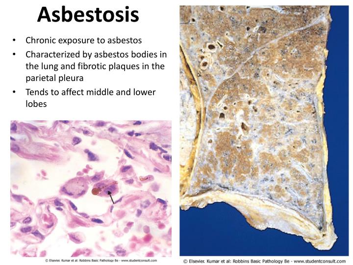 PPT - Respiratory Diseases PowerPoint Presentation - ID:1872347