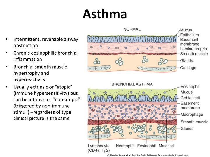 PPT - Respiratory Diseases PowerPoint Presentation - ID:1872347