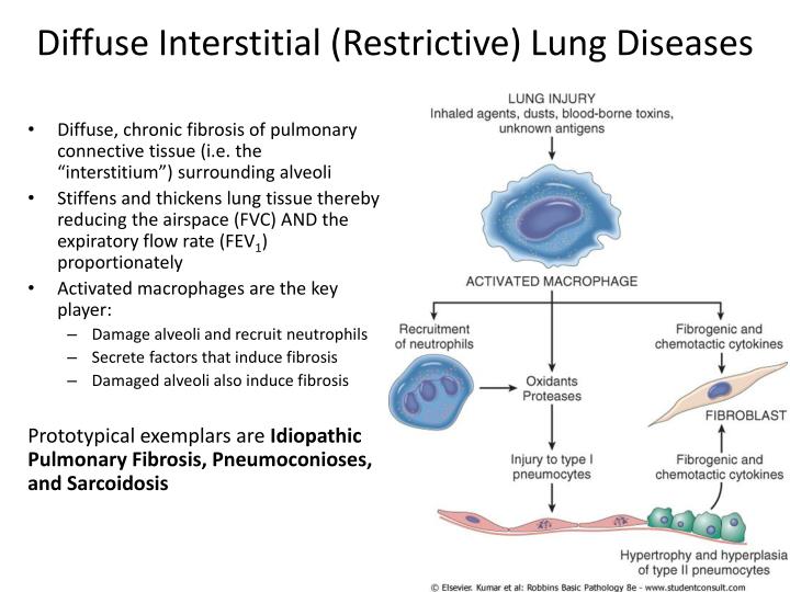 PPT - Respiratory Diseases PowerPoint Presentation - ID:1872347