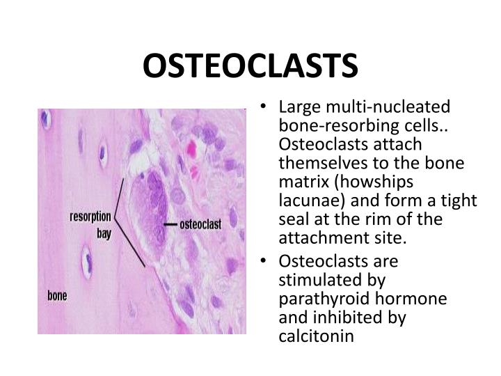 PPT - BONE PowerPoint Presentation - ID:1872550