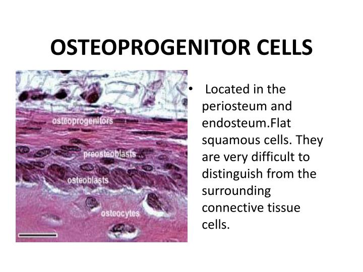 PPT - BONE PowerPoint Presentation - ID:1872550