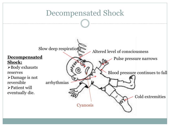 PPT - Shock and Bleeding in the Trauma Patient PowerPoint Presentation ...