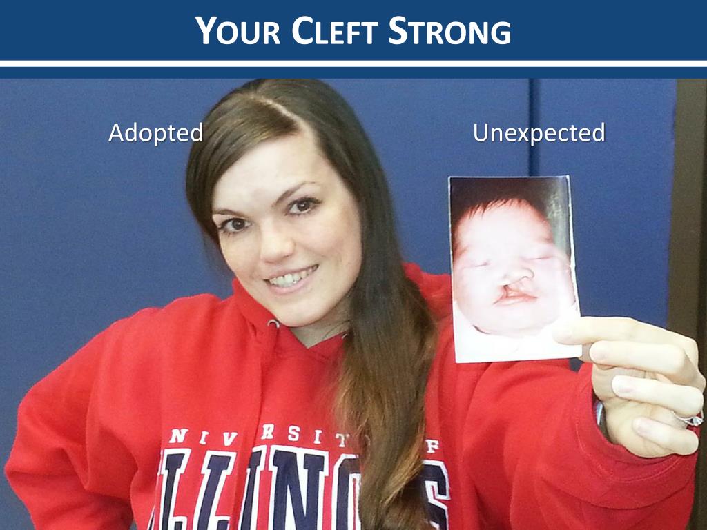PPT - Strengthening Emotional Resilience for Colorado Cleft Conference ...