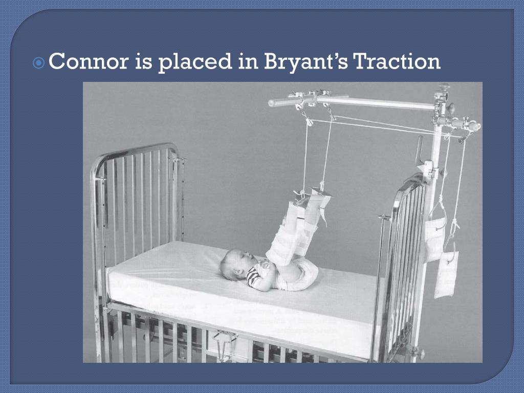 PPT - Mobility: Adult & Pediatric Fracture Case Studies PowerPoint ...