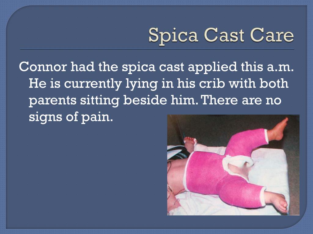 PPT - Mobility: Adult & Pediatric Fracture Case Studies PowerPoint ...