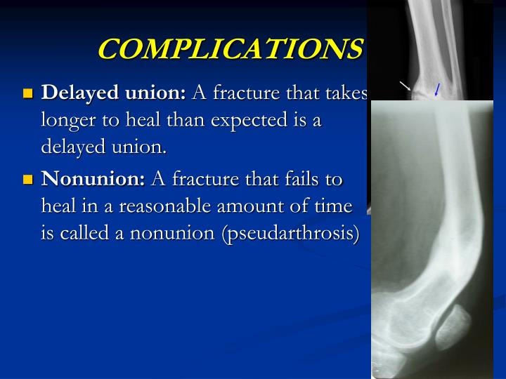 PPT - MUSCULOSKELETAL BLOCK Pathology Lecture 1: Fracture and bone ...