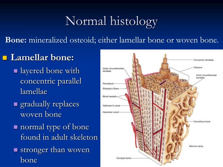 PPT - MUSCULOSKELETAL BLOCK Pathology Lecture 1: Fracture and bone ...