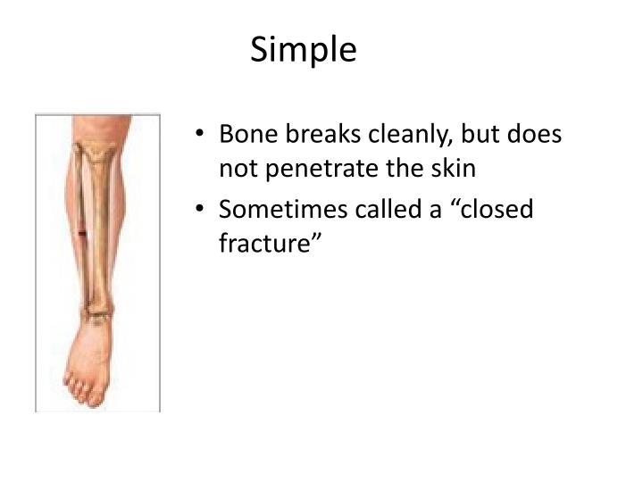 PPT - Bone Formation, Growth and Remodeling PowerPoint Presentation ...