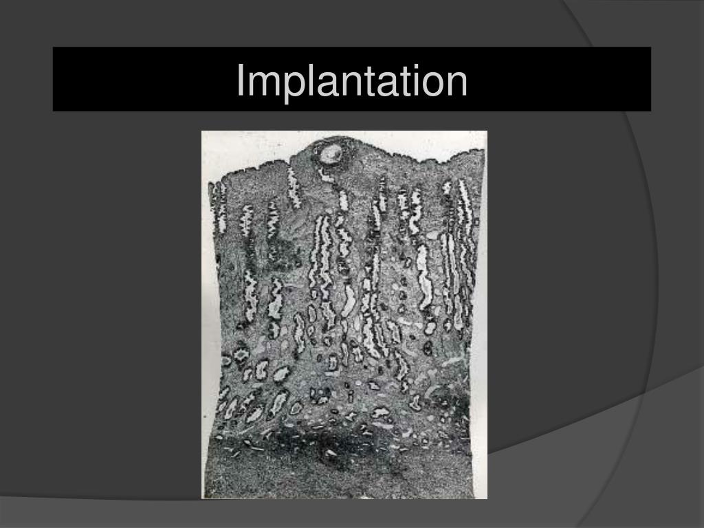 PPT - IMPLANTASI, selaput ekstra embrionik DAN PLASENTA si PowerPoint ...