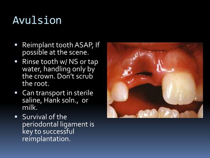 PPT - Oral dental emergencies PowerPoint Presentation - ID:1880246