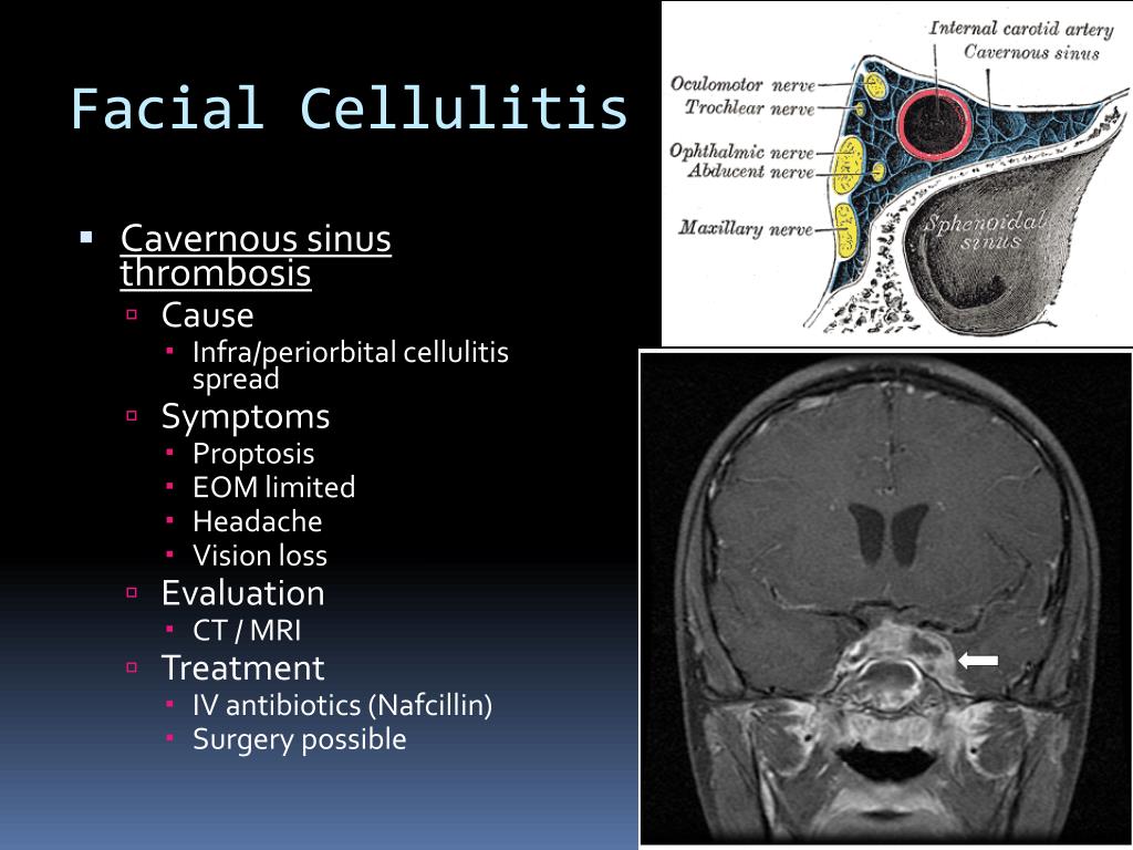 PPT - Oral dental emergencies PowerPoint Presentation, free download ...