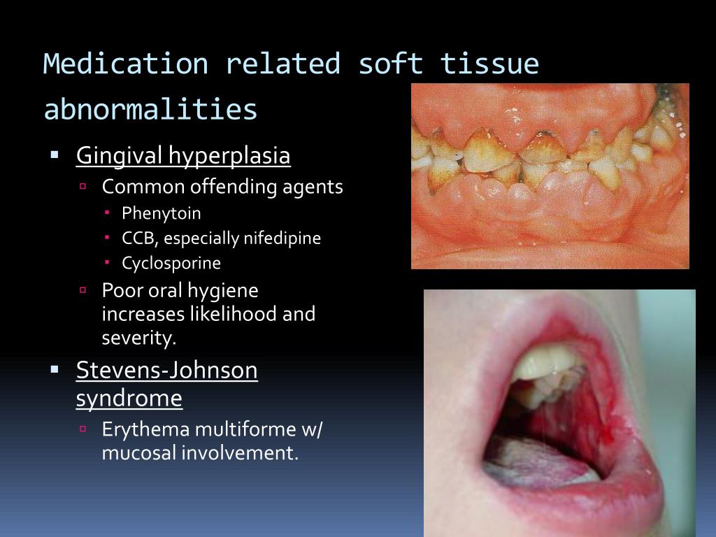 PPT - Oral dental emergencies PowerPoint Presentation, free download ...