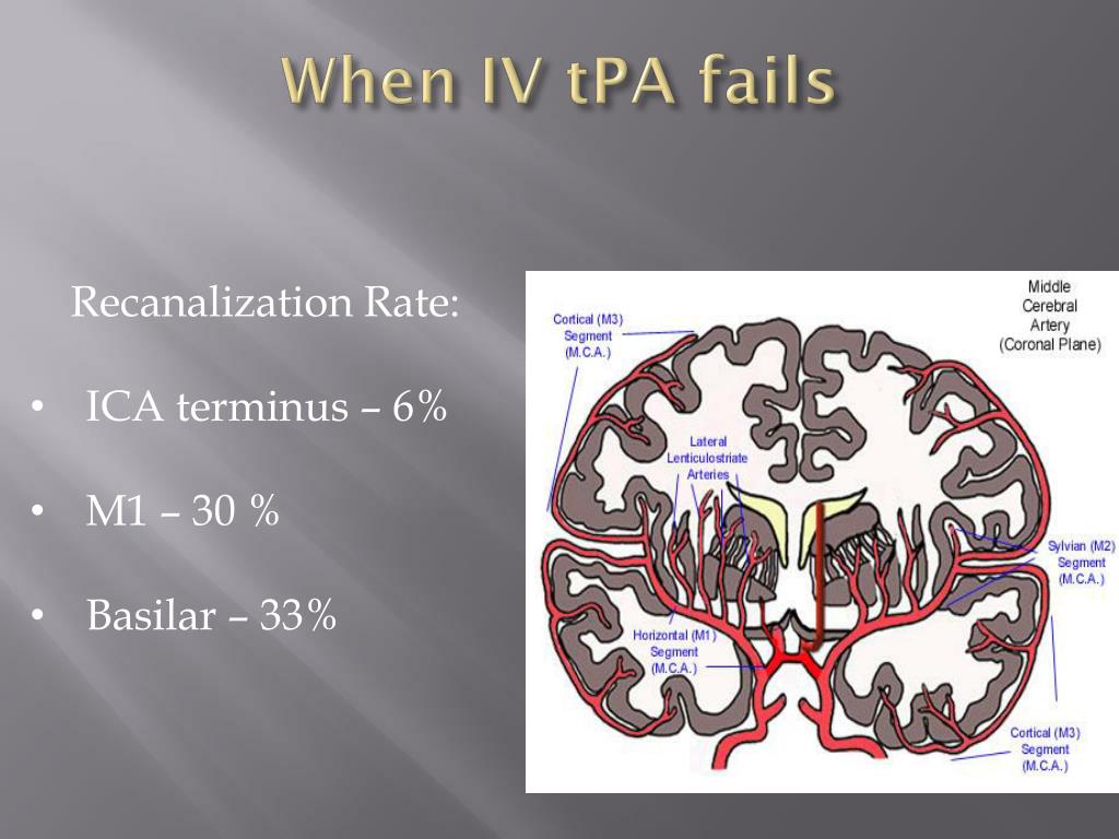 PPT - Regionalized Stroke Care Vision for the Upper Peninsula ...