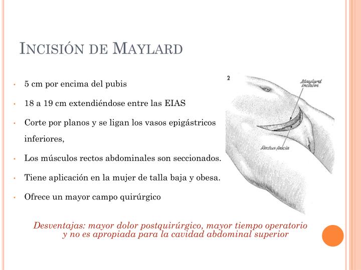 PPT - Operación Cesárea PowerPoint Presentation - ID:1887476