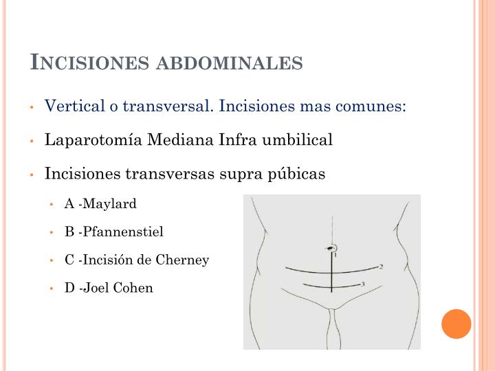 PPT - Operación Cesárea PowerPoint Presentation - ID:1887476