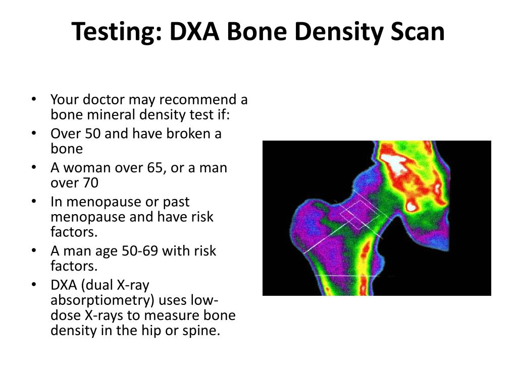 PPT - Dr. Zhao TCM Help Osteoporosis! PowerPoint Presentation, free ...