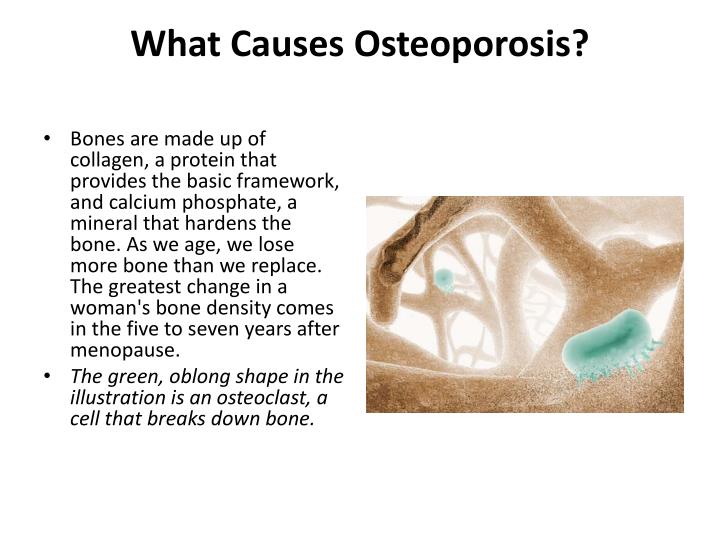 PPT - Dr. Zhao TCM Help Osteoporosis! PowerPoint Presentation - ID:1887550