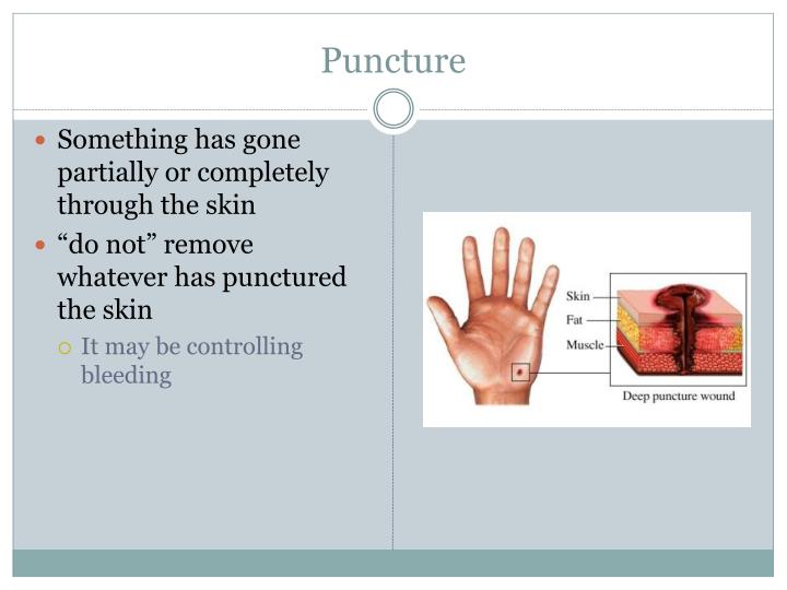 PPT - Injury Evaluation Terminology PowerPoint Presentation - ID:1889441