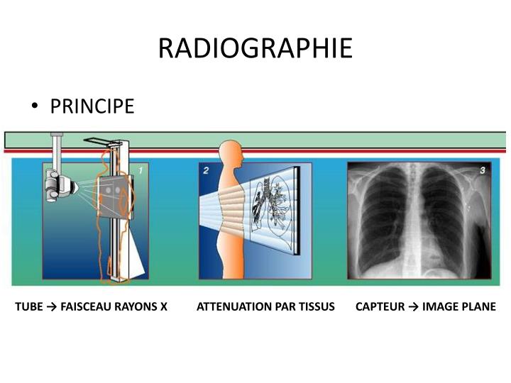 PPT - RADIOGRAPHIE & ECHOGRAPHIE Bases techniques Sémiologie générale ...