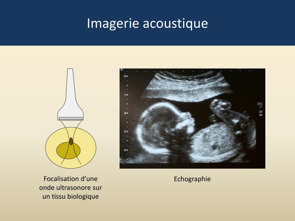 PPT - L’imagerie médicale, aujourd’hui et demain PowerPoint ...