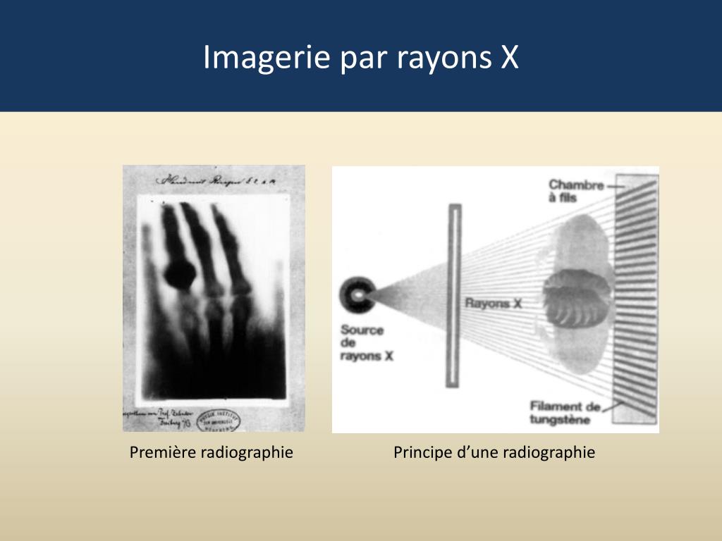PPT - L’imagerie médicale, aujourd’hui et demain PowerPoint ...