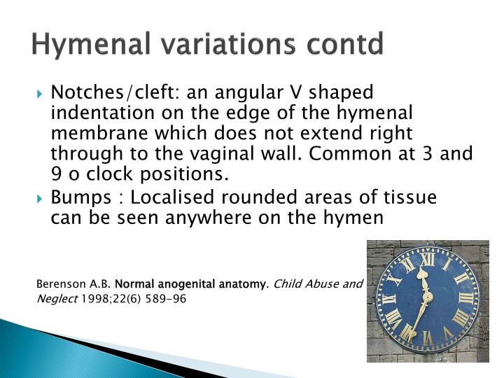 PPT - Genital examination technique and findings in sexually abused ...