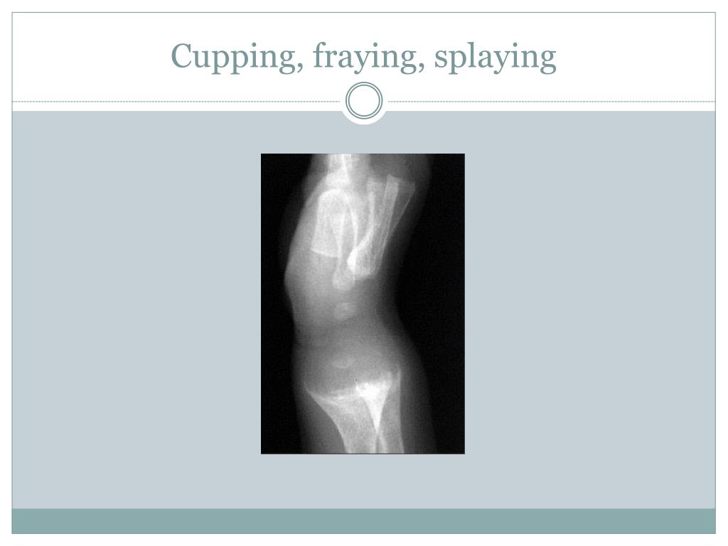 PPT - Family Medicine Study: Infant Nutrition PowerPoint Presentation ...