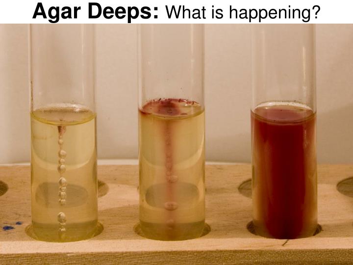 PPT - Ex. 8 : Aseptic Technique – Inoculating Different Types of Media ...