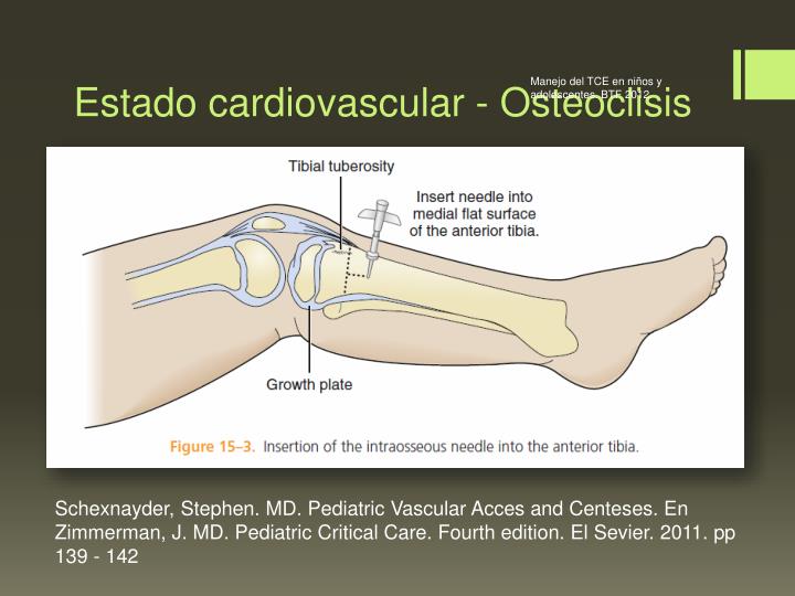 PPT - TCE grave en pediatría PowerPoint Presentation - ID:1895390