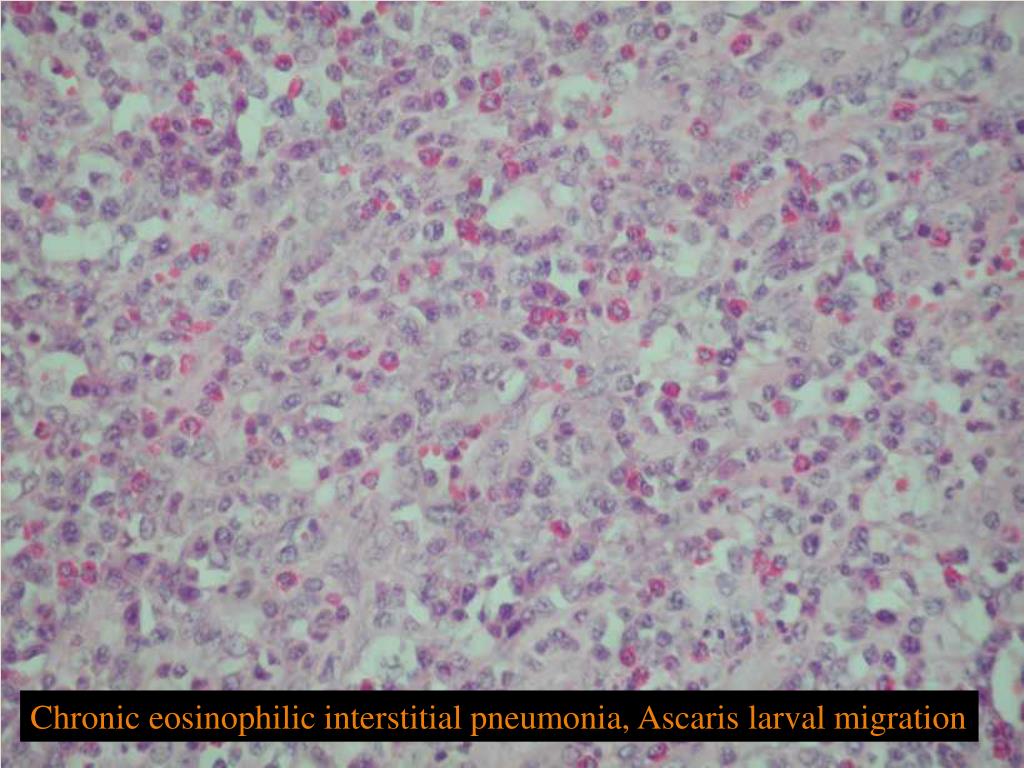 PPT - Pathogenesis and pathology of porcine pneumonias PowerPoint ...