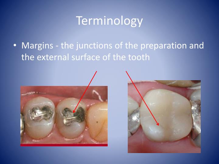 PPT - Dental Terminology PowerPoint Presentation - ID:1897364